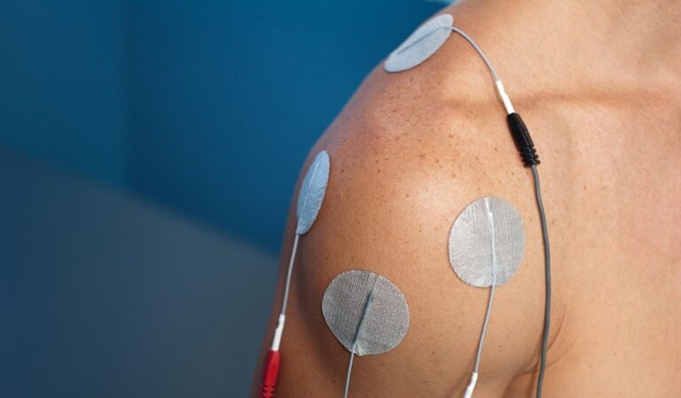 NERVE CONDUCTION STUDIES (NCS) & ELECTROMYOGRAPHY (EMG) - Neurocare